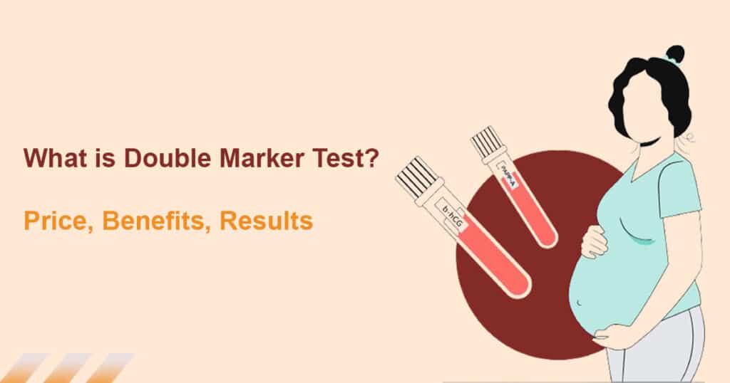 What is Double Marker Test? Price, Benefits, Results - Risaa IVF