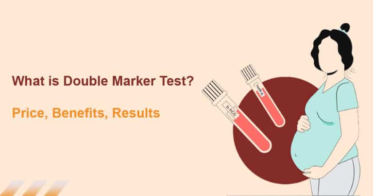 What is Double Marker Test? Price, Benefits, Results - Risaa IVF