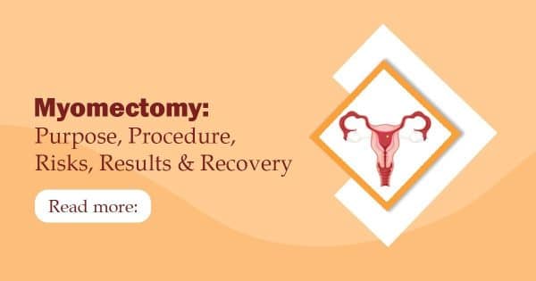 Myomectomy Surgery: Purpose, Procedure, Risks, & Recovery