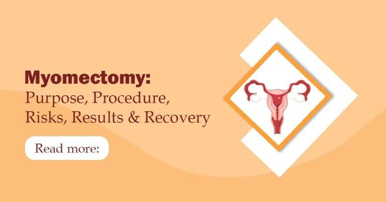 Myomectomy Surgery: Purpose, Procedure, Risks, & Recovery