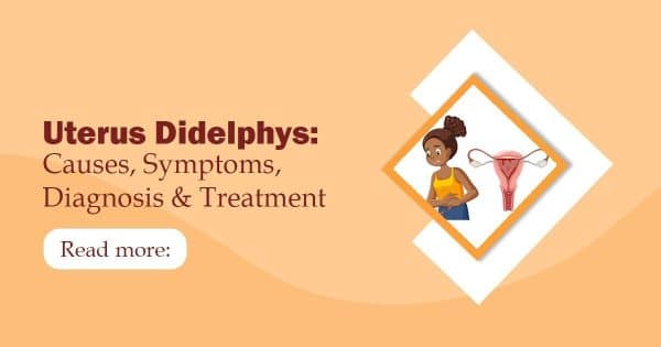 Uterus Didelphys: Causes, Symptoms, Diagnosis & Treatment