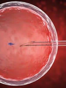 Best IMSI treatment in Delhi | IMSI Centre in Delhi