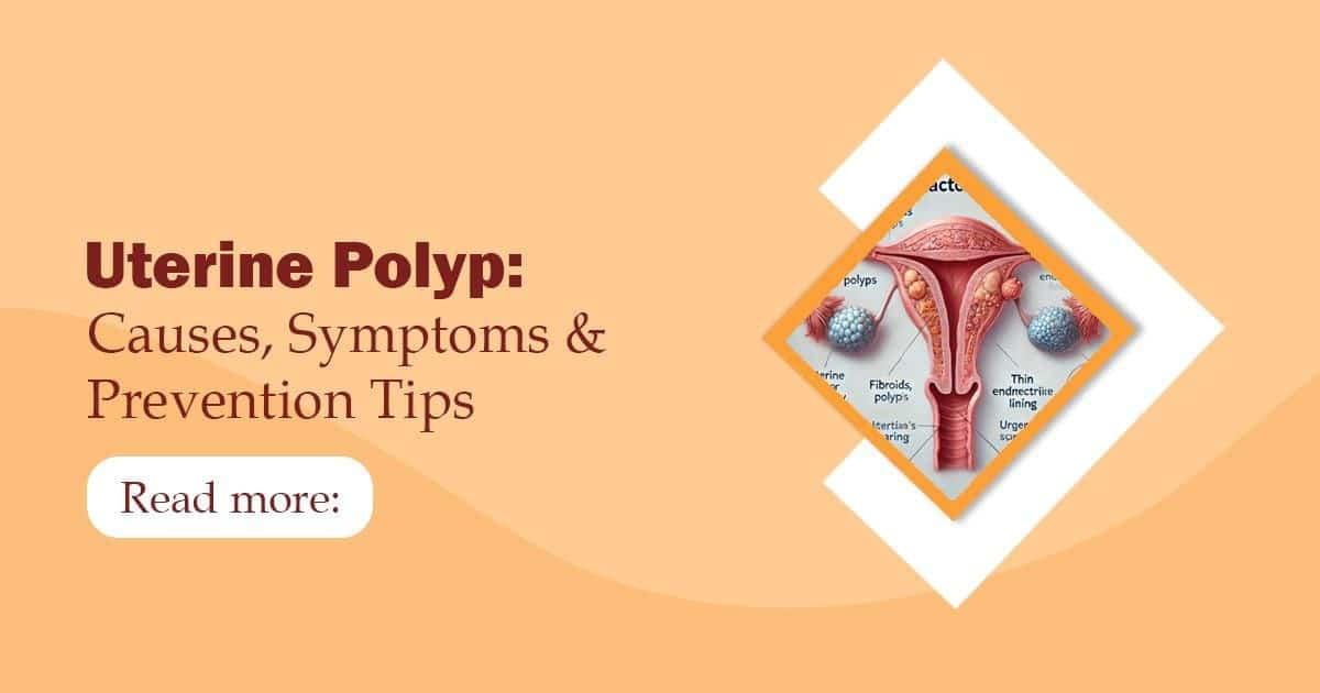 hyperplastic polyp icd 10